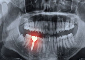 Digital X-Ray, Ultrasound, ECG, OPG, Pathology Lab Test in Badarpur Delhi